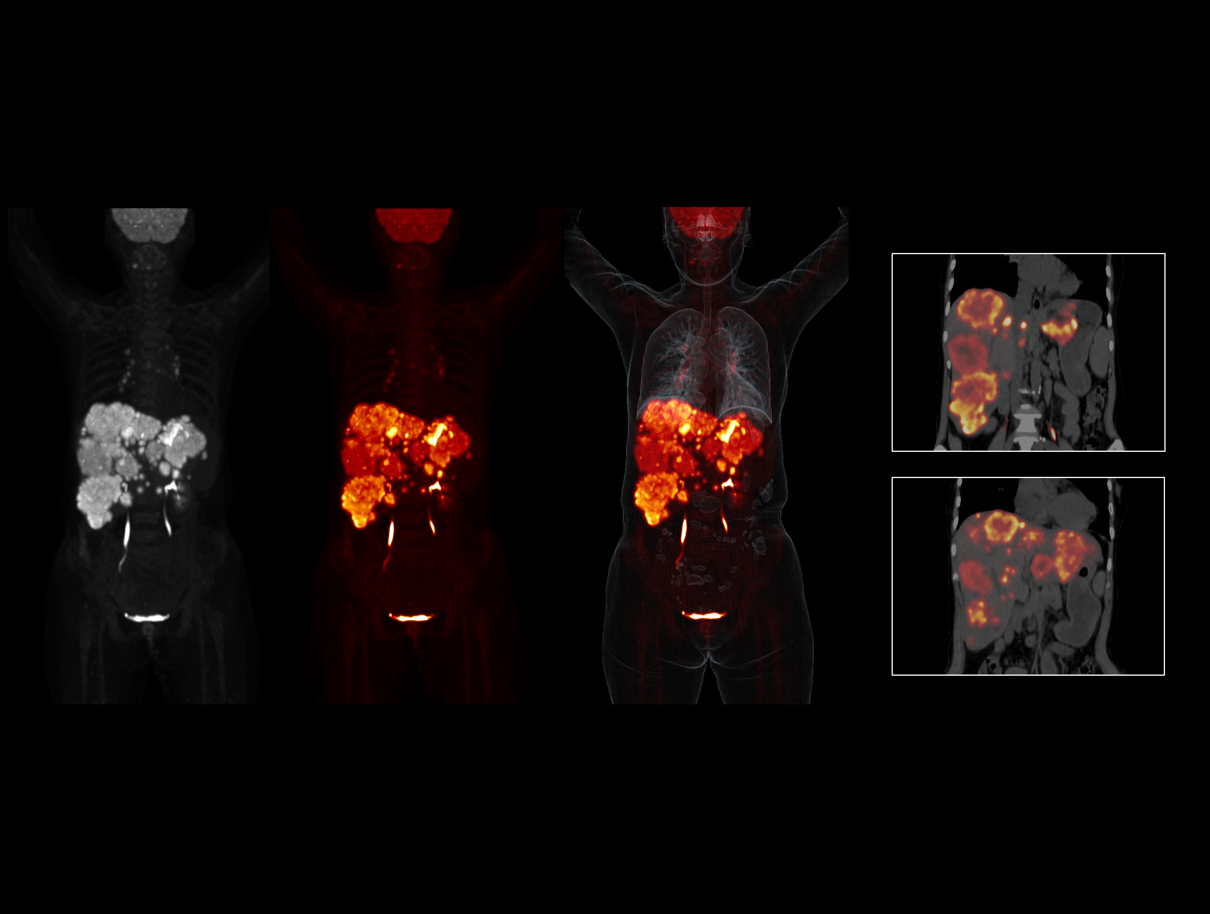 uMI Panorama™️ - United Imaging