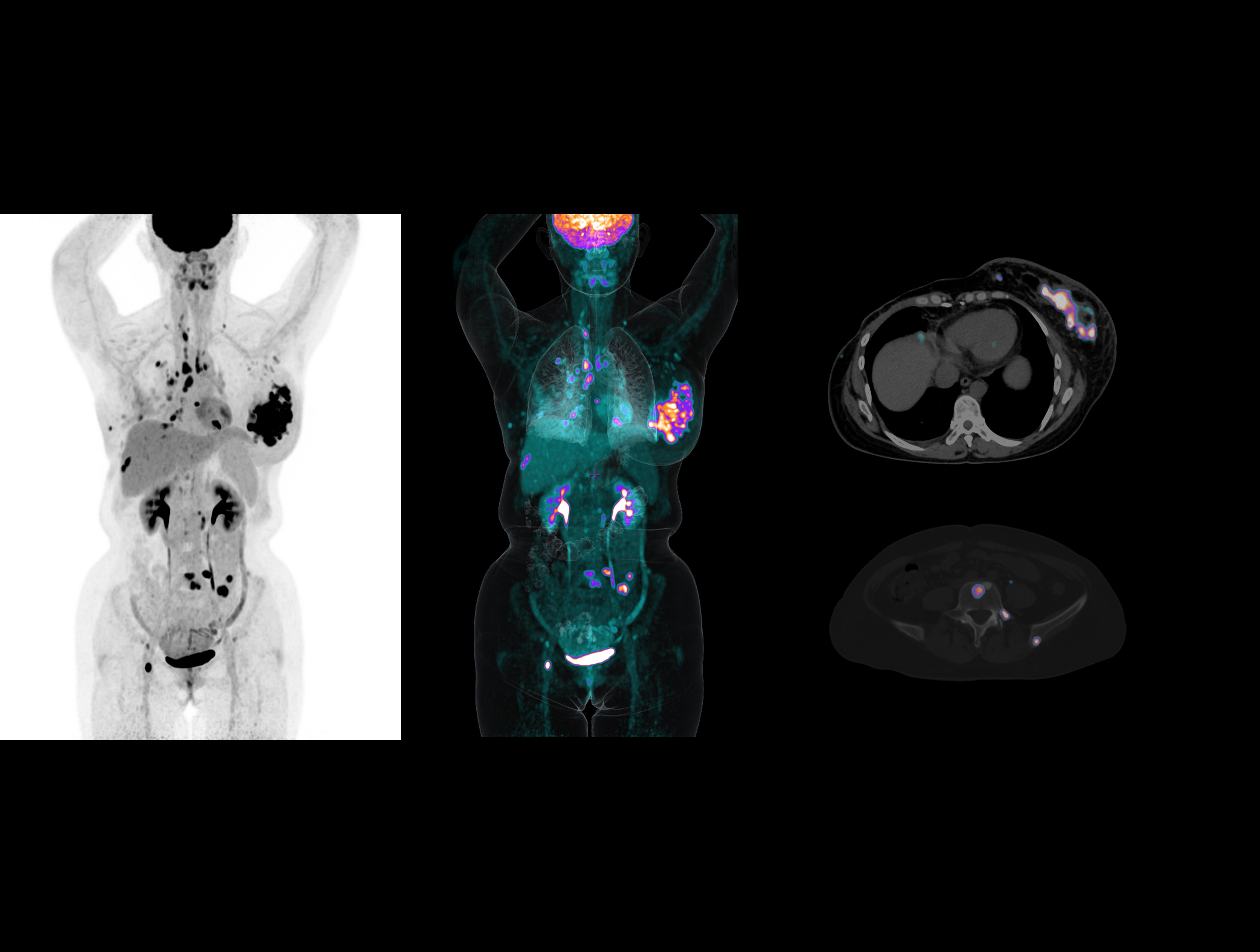 uMI Panorama™️ - United Imaging