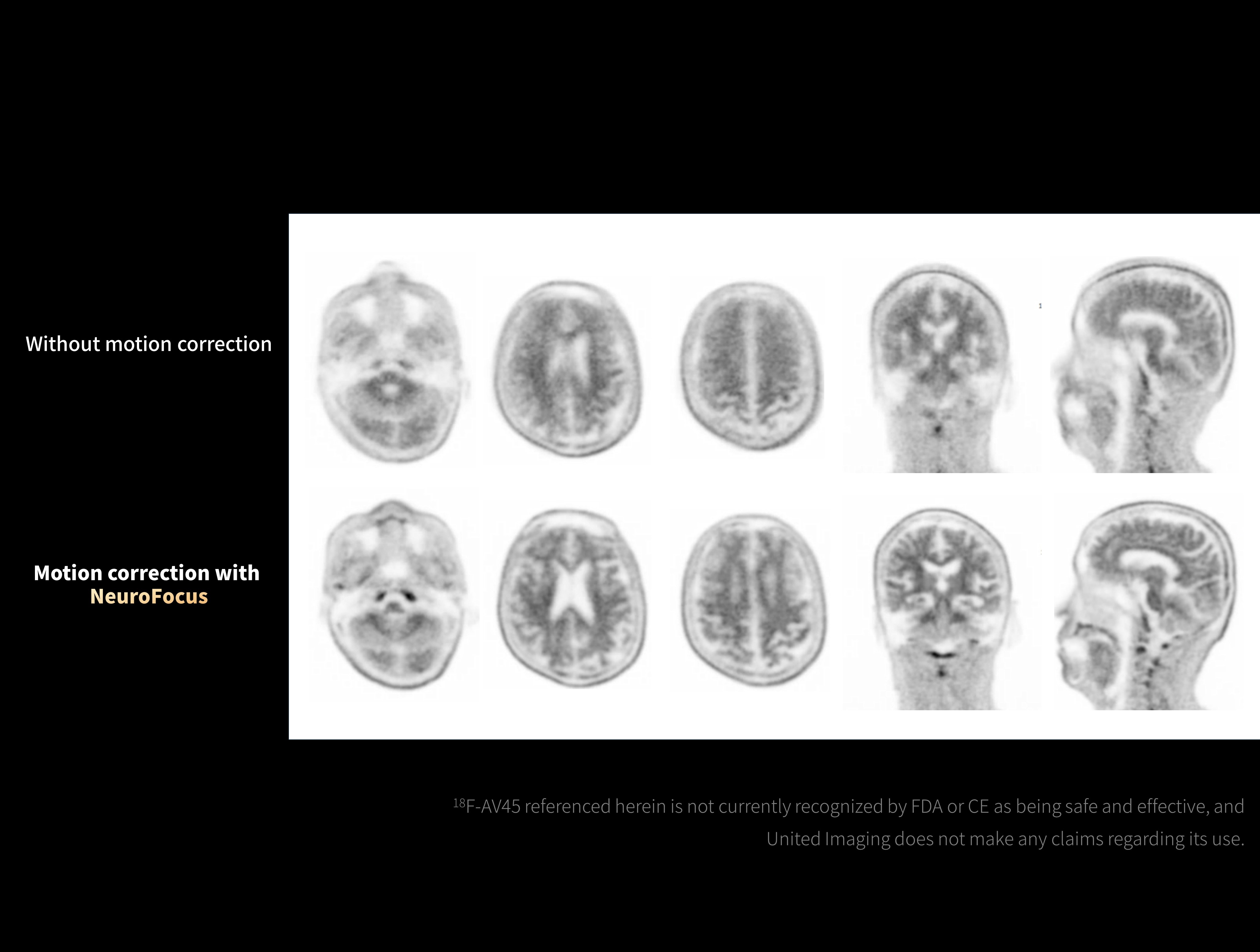uMI Panorama™️ - United Imaging