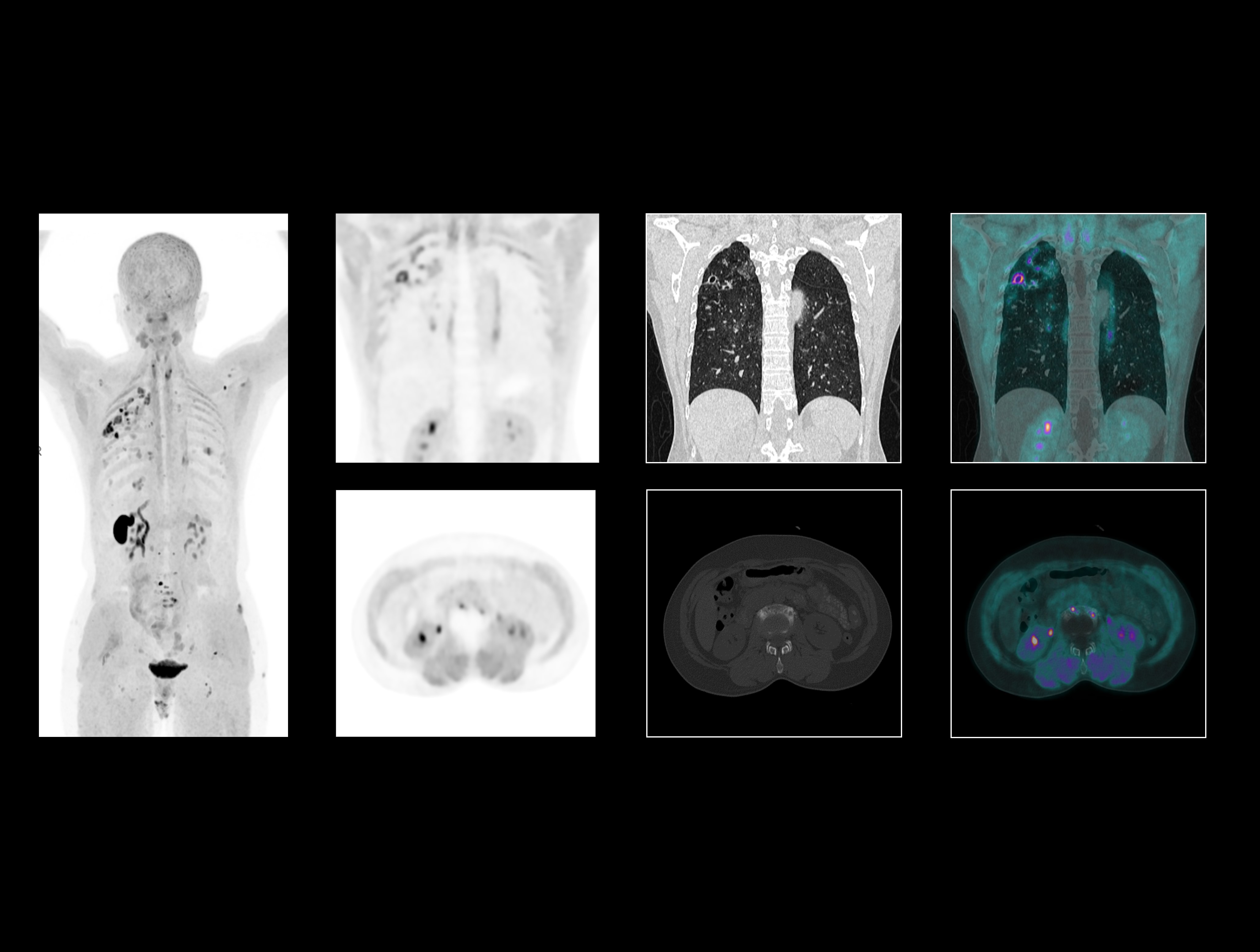 uMI Panorama™️ - United Imaging