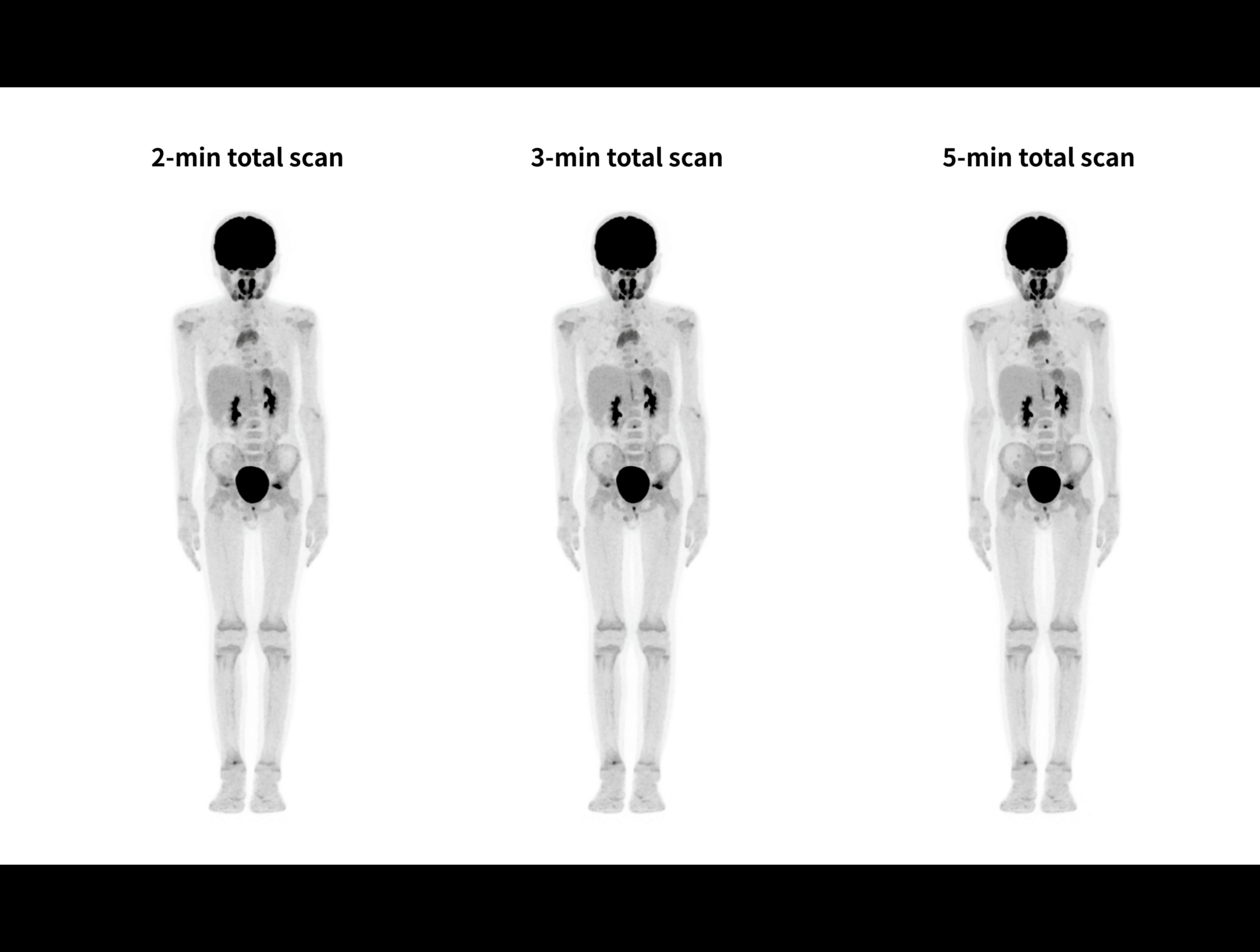 uMI Panorama™️ - United Imaging