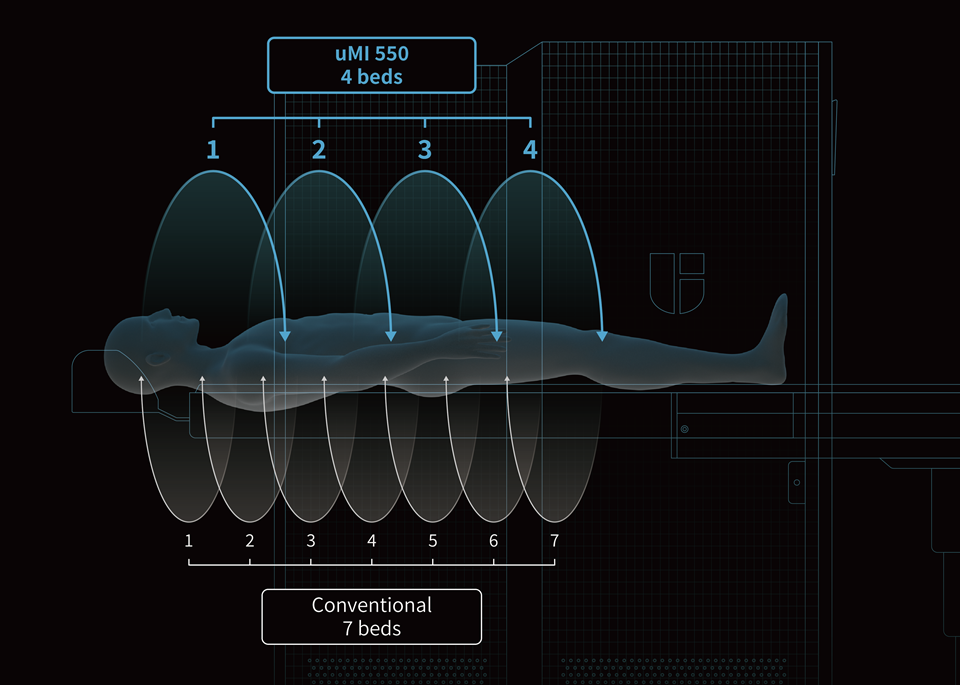 uMI 550: Digital PET/CT | United-Imaging Healthcare