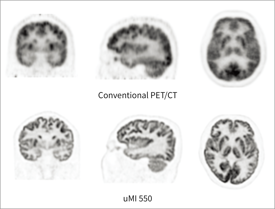uMI 550: Digital PET/CT | United-Imaging Healthcare