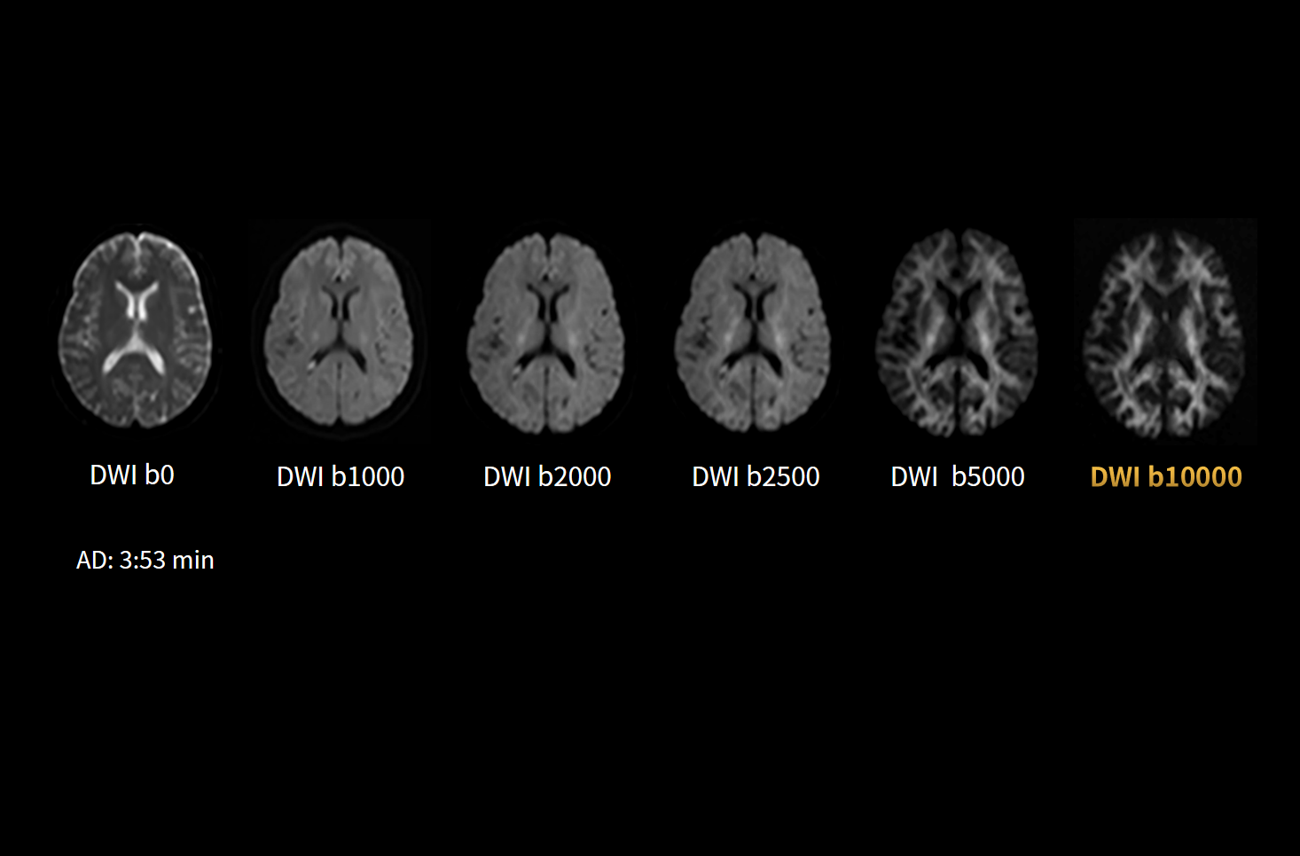 uMR® 680: uAIFI DeepRecon+EasySense | United-Imaging